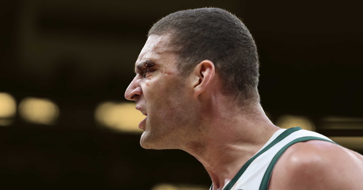 Kings troll bloody Brook Lopez with "Bleeding love" - Basketball ...