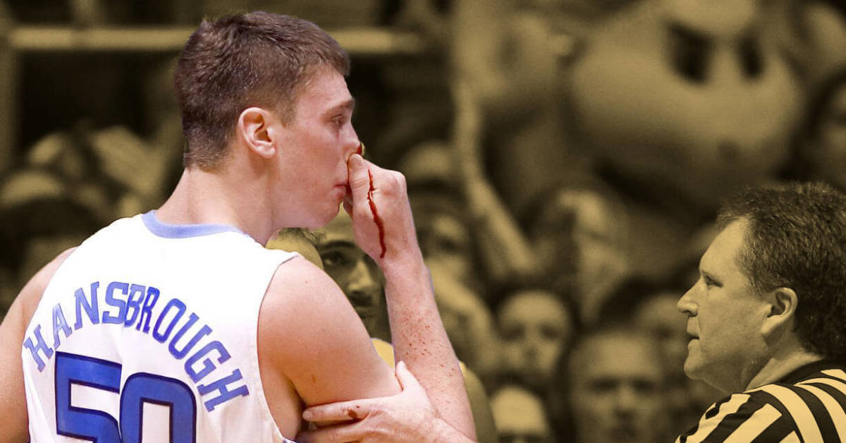 Tyler Hansbrough Broken Nose Roy Williams' Top 8 North Carolina Duke